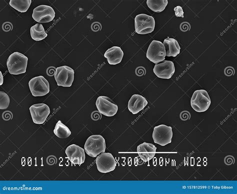 Many Hornbeam Pollen Grains Scanning Electron Micrograph Stock Image
