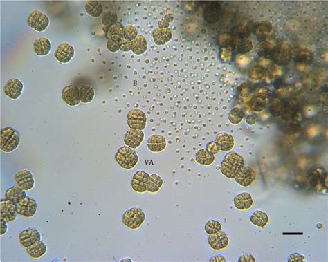 Characteristic Vegetative Cell Aggregates Va And Baeocytes B Of Gi1