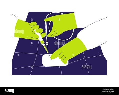 Endovascular Surgery Abstract Concept Vector Illustration Stock Vector