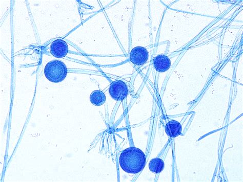 Penicillium Under Microscope 100x