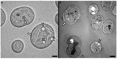 低电压台式透射电镜vs传统透射电镜：细胞超微结构成像结果对比 知乎