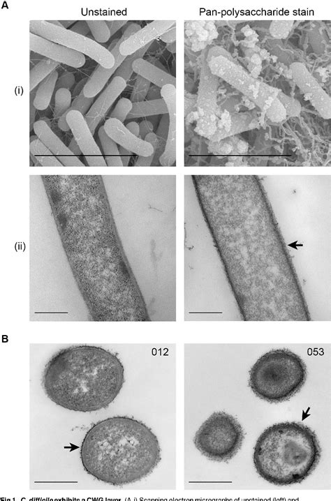 Table 1 From A Clostridium Difficile Cell Wall Glycopolymer Locus Influences Bacterial Shape