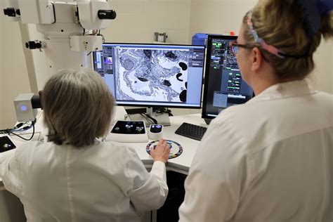 Electron Microscopy Laboratory Mcgovern Medical School