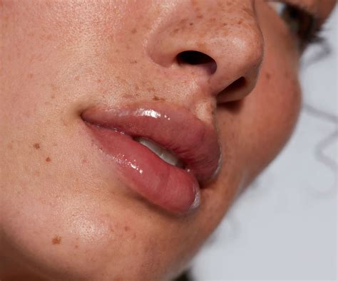 About The Juvederm Filler Collection JuvÉderm® Official