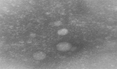 Tem Image Of Gemini Epo Nanomicellsin Pbs Ph 72 Negative Staining