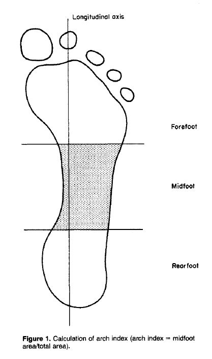 Application Of The Wet Test” And Static Arch Height For Assigning