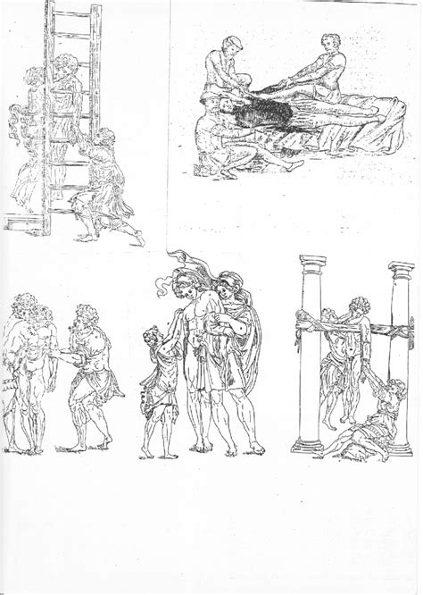 Hippocratic Methods For Reduction Of Shoulder Dislocation Employing Download Scientific