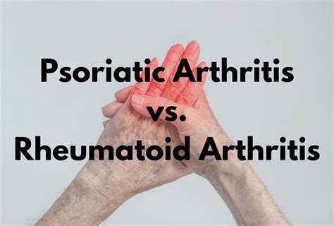 Psoriatic Arthritis Vs Rheumatoid Arthritis Dr Badhan Firstchoice