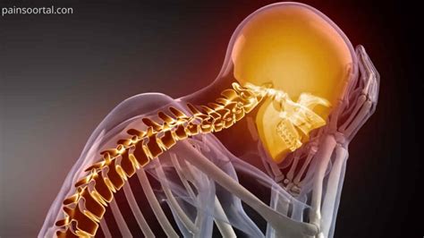 Spinal Headache Location Causes And Treatment Pains Portal