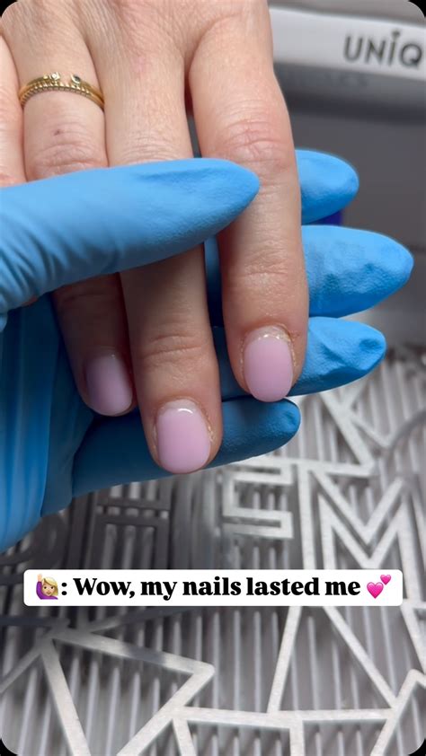 Why Are The Sidewalls In This Condition Incorrect Hard Gel Reinforcement Often Leads To These