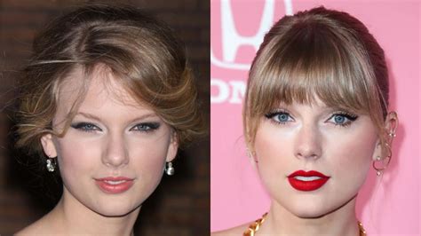 Taylor Swift Surgery Taylor Swift Before And After From 2006 To 2024