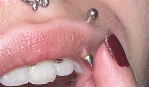 Angel Fangs Bump Rpiercing