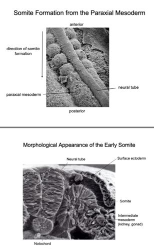 D And R Bio Somite Patterning And Derivatives Flashcards Quizlet