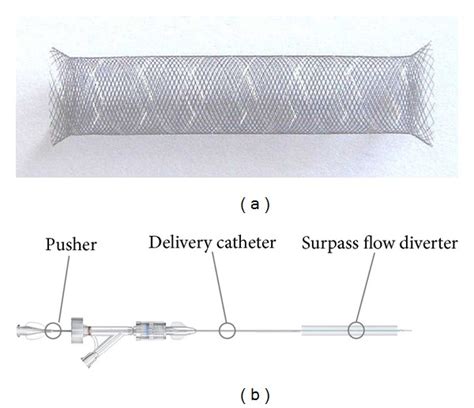 Flow Diverters For Intracranial Aneurysms Pmc