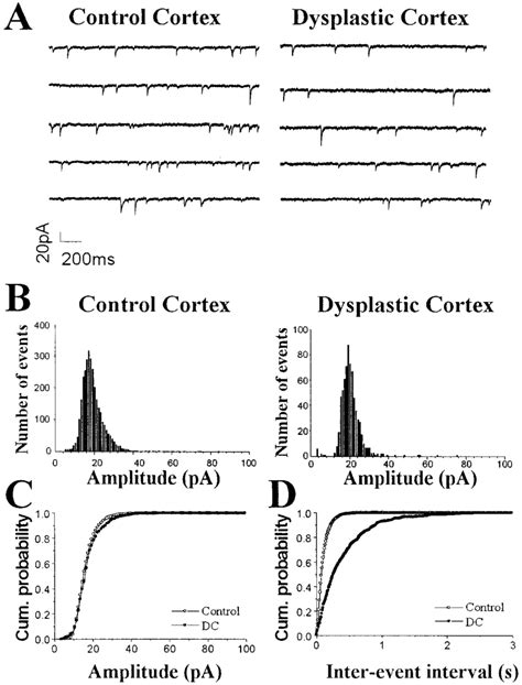 Decreased Frequency Of Mipscs In Pyramidal Neurons From Dysplastic