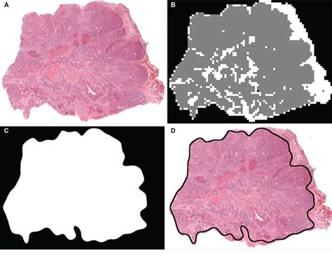 Automated Tumor Analysis For Molecular Profiling In Lung Cancer