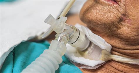 Tracheostomy Procedure Aftercare Recovery And Results