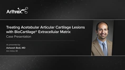 Arthrex Treating Acetabular Articular Cartilage Lesions With