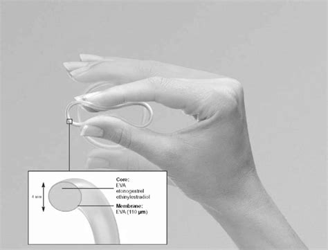 The Combined Contraceptive Vaginal Ring Nuvaring ® Download