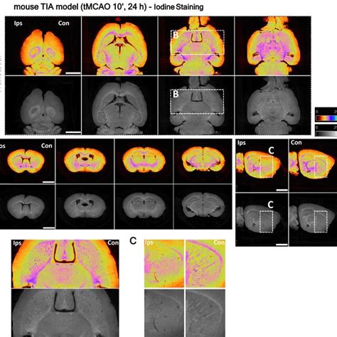Visualization Of Brain Lesions In Mouse Stroke Model Tmcao By Download Scientific Diagram
