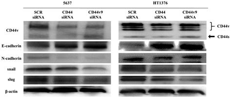 Clinical Significance Of Cd44 Variant 9 Expression As A Prognostic