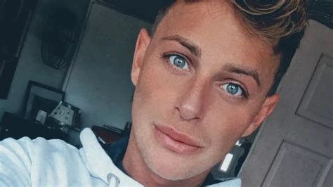 I Couldnt Have Sex For 12 Weeks After Botched Brazilian Bum Lift In