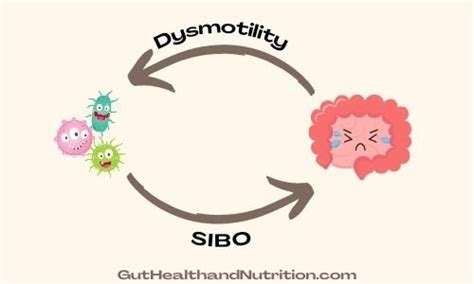 The Migrating Motor Complex Mmc And Sibo Gut Health And Nutrition