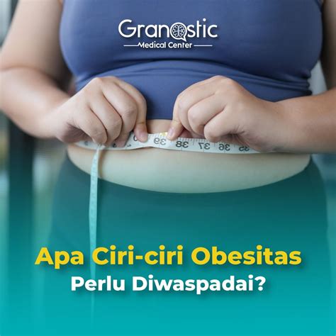 Apa Ciri Ciri Obesitas Yang Perlu Diwaspadai Ini Menurut Ahli