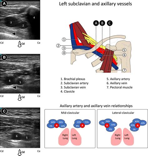 Anatomic Landmarks For Interventional Procedures — Ini Cet Lesson