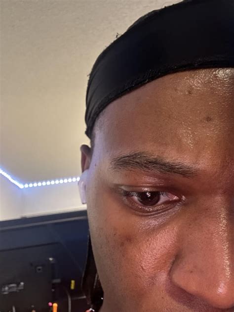 Routine Help Dark Skin Hyperpigmentation Men I Have Dark Spots I Am