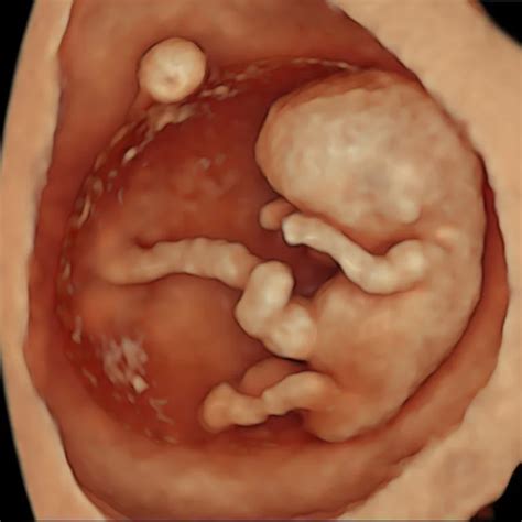 Foot Fetus Definition At Margaret Ratliff Blog