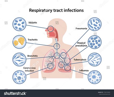 Bronchitis Bacteria