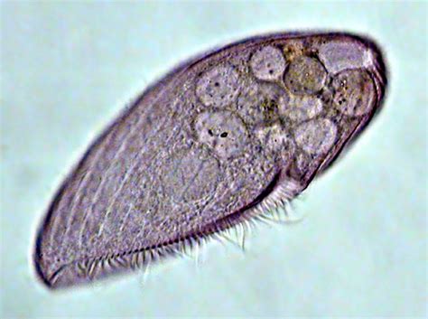 Labeled Blepharisma