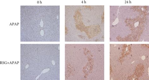 Rosiglitazone Pretreatment Mitigated Apap Induced Hepatic Pan Necrosis