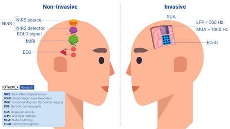 Visualizing Human Thought Idtechex Explores Brain Computer Interface Wearable Technology