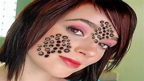 Trypophobia I Haz It