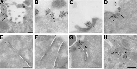 Mu Lcs Internalize Hiv 1 Into Birbeck Granules Transmission Electron