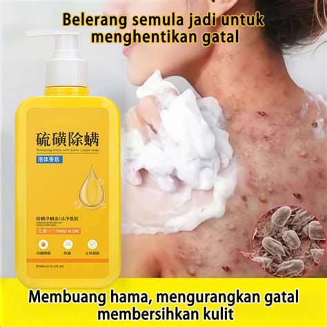 Sulfur Eczema Body Wash Sulfur Body Wash Eczema Body Wash Antibacterial