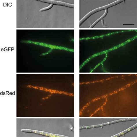 Localization Analysis Of Rtt109 By Fluorescence Microscopy Rtt109 Was