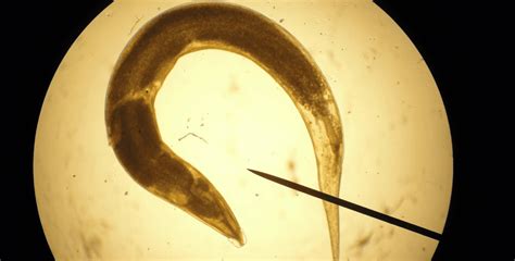 Understanding Enterobiasis Pinworm Infection