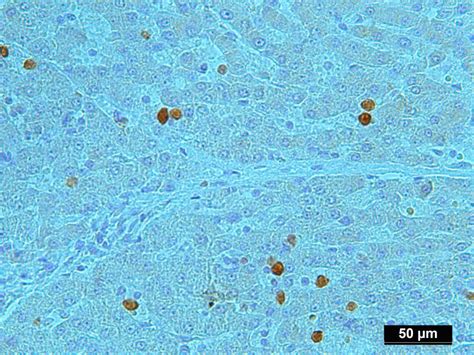 Human Liver Tissue Normal Ffpe Sections Human Liver Tissue Normal Ffpe Sections