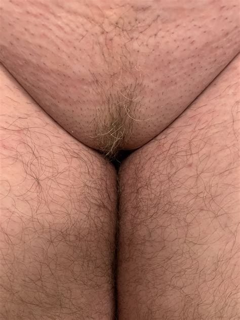 Happy Hairline 3 Pics Xhamster