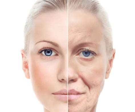 Glycation Skin And Face Wrinkles Causes Recommendations And Treatment