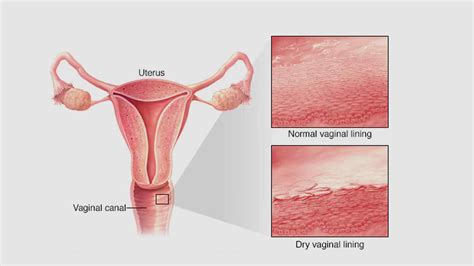 Vaginal Itching And Swelling