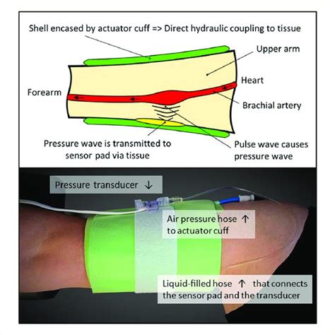 Grolleau Classification In Violet The Theoretical Breast Size In Download Scientific Diagram
