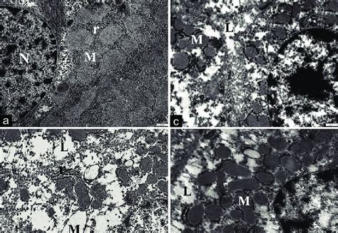 Electron Micrographs From Control Liver A Showed The Hepatocytes With