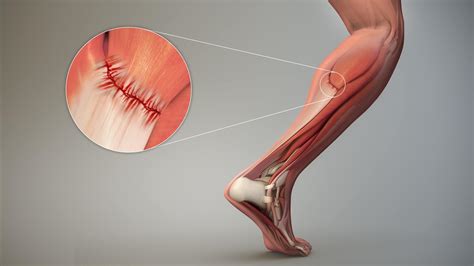 These Self Healing ‘living Gels Could Revolutionize Medicine And