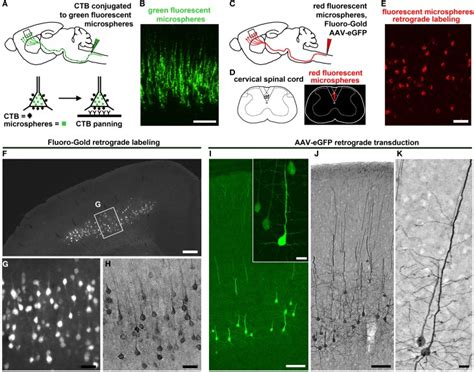 Csmn Retrograde Labeling And Transduction Approaches A Schematic Download Scientific Diagram