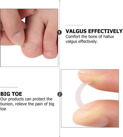 2pcs Ingrown Toenail Corrector Ingrown Toenail Tape Toenail Correction Sticker Ingrown Toenail