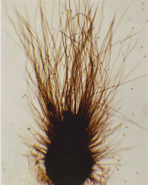 Example Chaetomium Globosum Adrian Carter Mycology